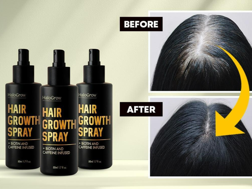 Halo Grow Hair Spray: The Revolutionary Topical Solution for Hair Loss ...